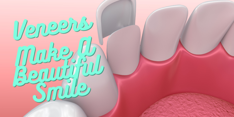 Dental Veneers | Rockwell Dentistry Hamilton