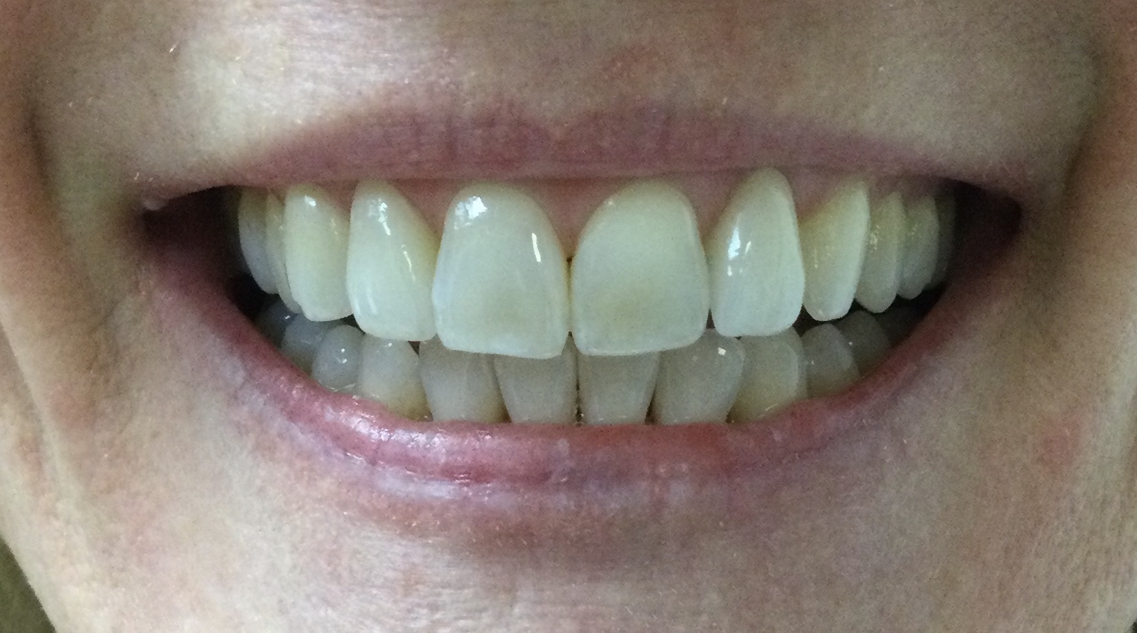 Family Dentistry, Emergency Dentist & General Dentistry | Hamilton ...